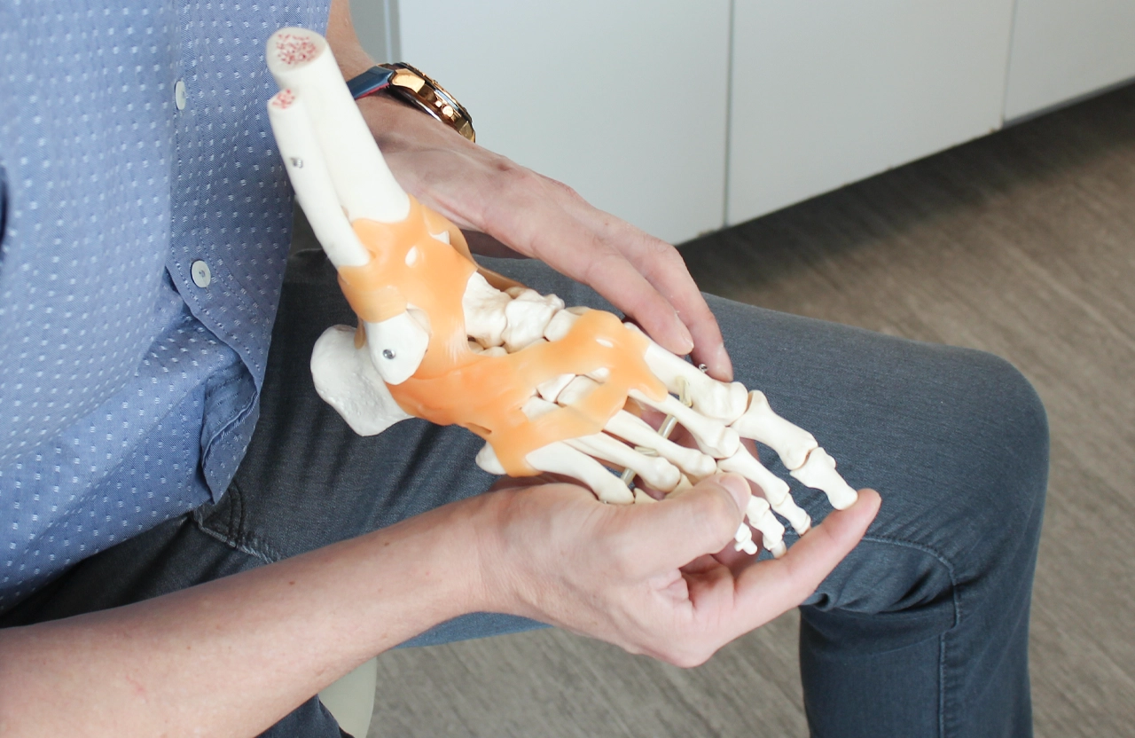 Broken Ankle: Symptoms, Surgery or No Surgery, and Recovery